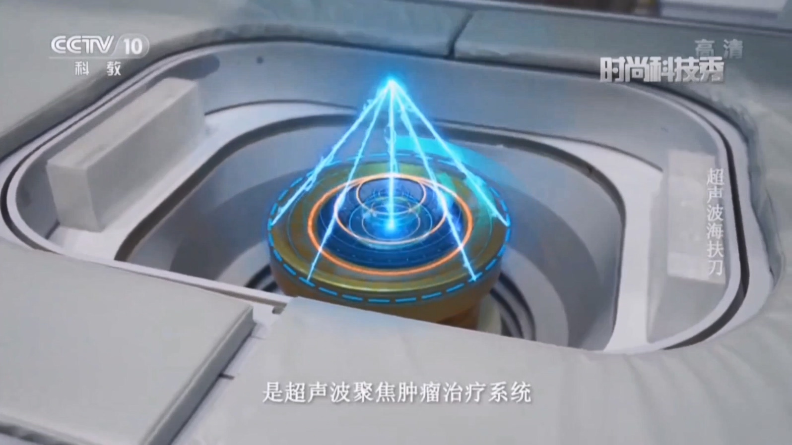 2020年12月17日 CCTV10创新进行时-超声“神刀”-海扶医疗_治疗——让病人受伤害更小！重庆海扶医疗科技股份有限公司拥有产品品牌_海 ...